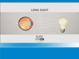Sure Vision | PPT