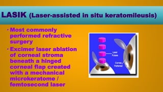 SURFACE ABLATION PRK , LASIK , SMILE | PPTX