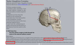 Surface anatomy of brain - Dr Sameep Koshti (consultant Neurosurgeon ...