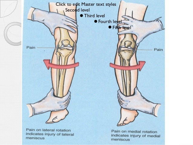 Surface Anatomy Of The Lower Limb