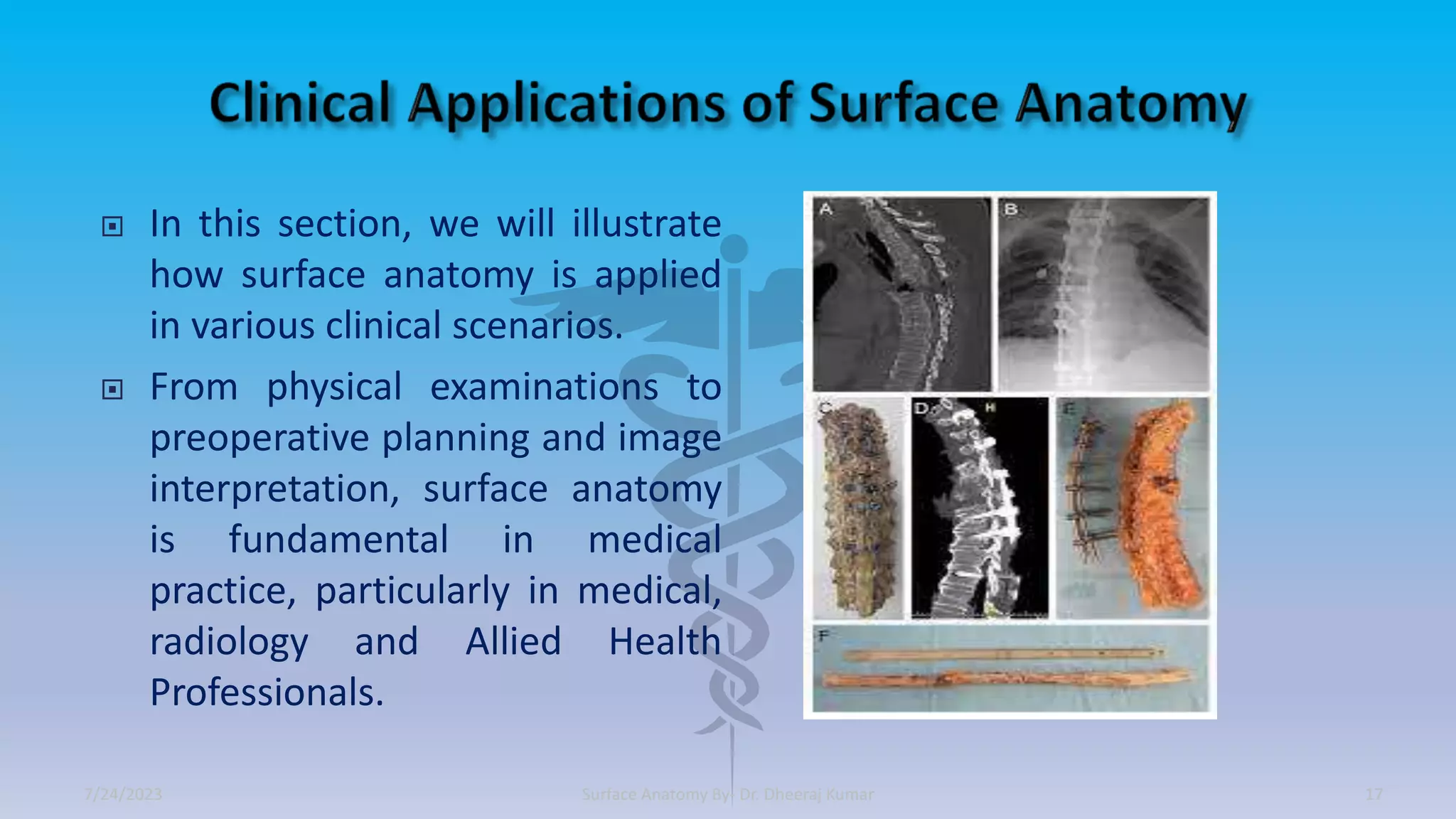 Surface Anatomy of Musculoskeletal, Vascular, and.pptx