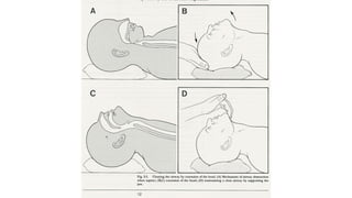 Normal Surface Anatomy of The Chest.pptx