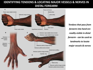 SURFACE ANATOMY OF UL 1.pptx - Repaired.pptx
