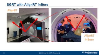 Surface Guidance Advancement Novel Usage of SGRT for CBCT-based ...
