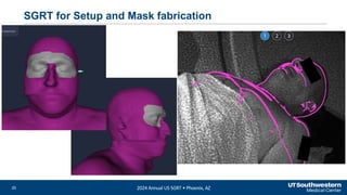 Surface Guidance Advancement Novel Usage of SGRT for CBCT-based ...