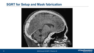 Surface Guidance Advancement Novel Usage of SGRT for CBCT-based ...
