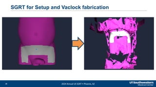 Surface Guidance Advancement Novel Usage of SGRT for CBCT-based ...