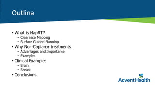 Surface Guided Planning for Breast Treatments | PDF