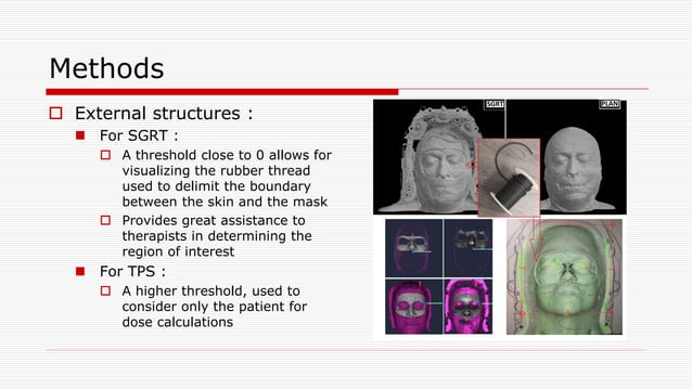 Surface Imaging for SRS Insights from St Louis Radiotherapy Center | PPT