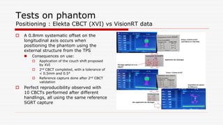 Surface Imaging for SRS Insights from St Louis Radiotherapy Center ...
