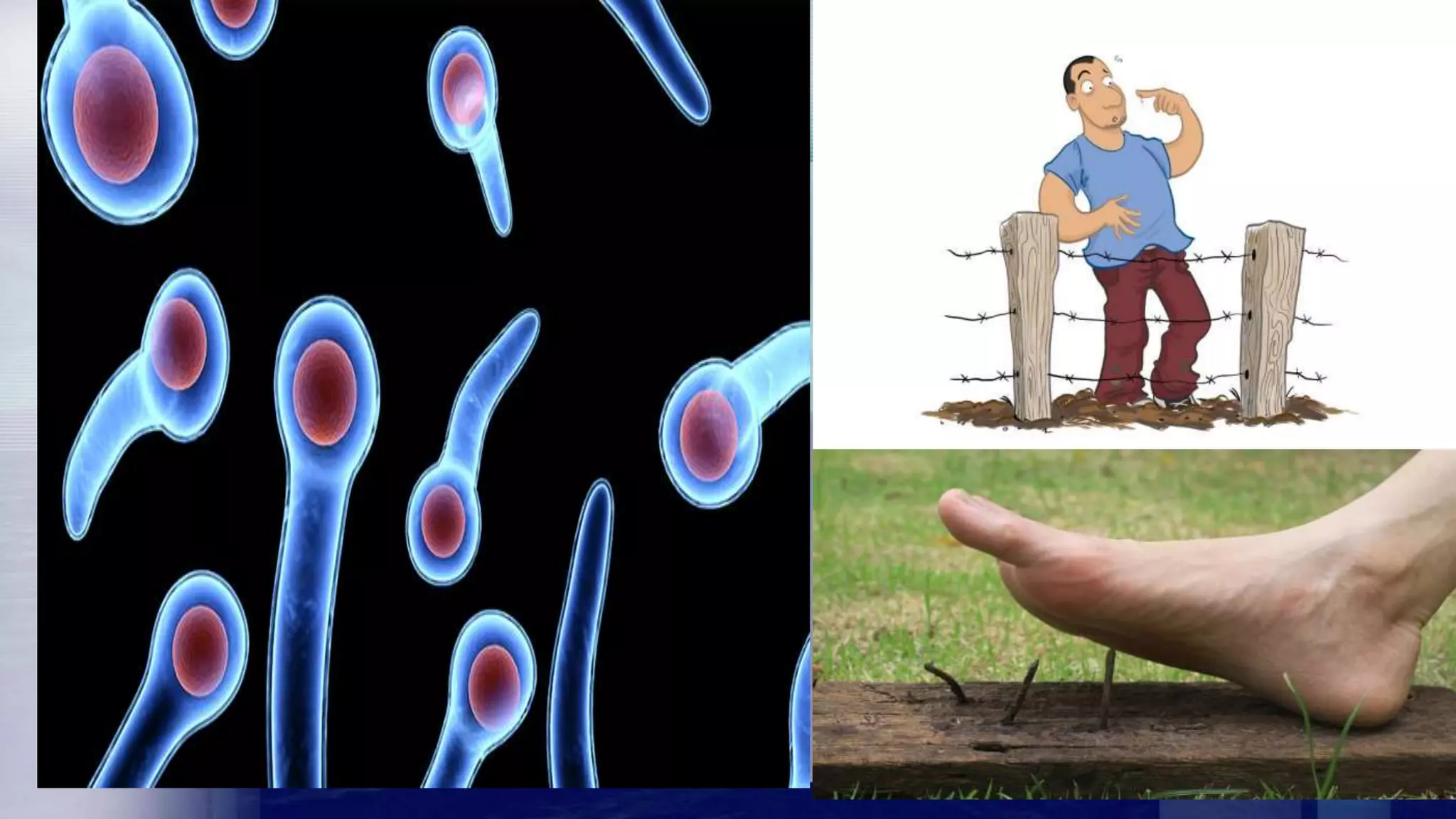 Surface infection | PPTX