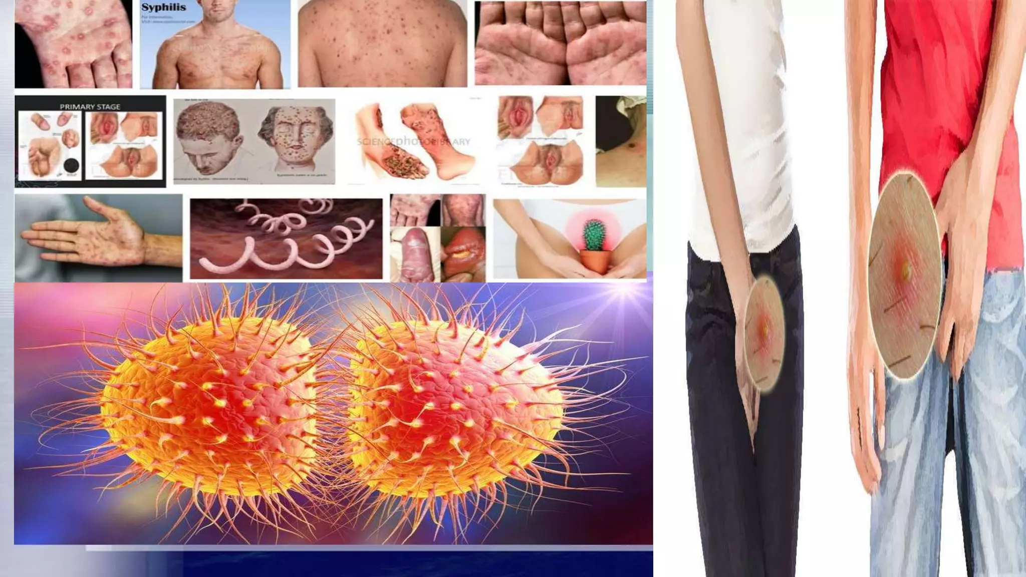 Surface infection | PPTX