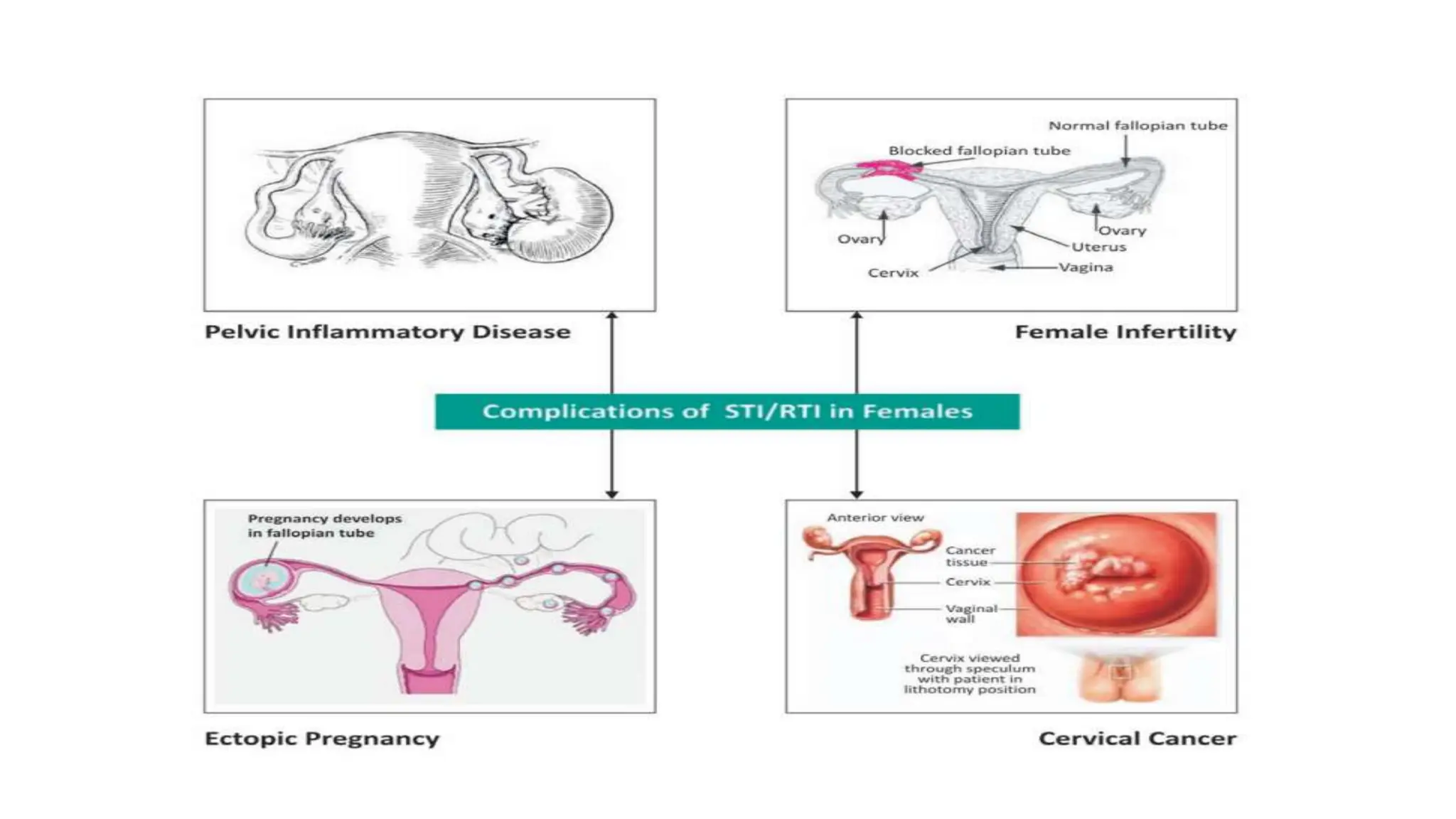 surface infections STD's /RTI's diseases.pptx