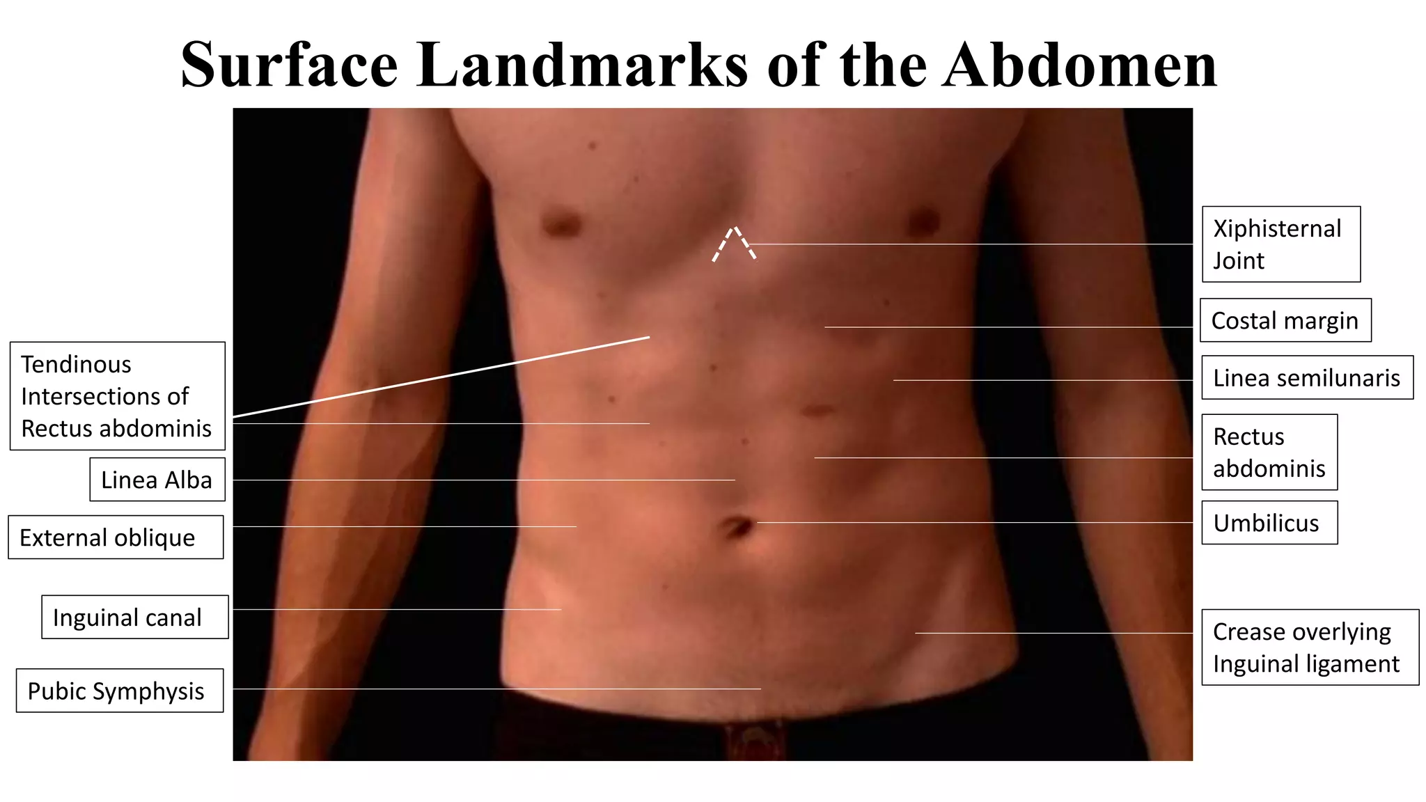 Surface landmark of the abdomen | PDF