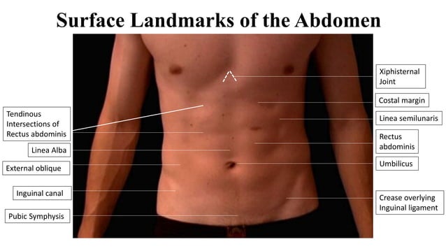 Surface landmark of the abdomen | PDF | Death, Injury, or Military ...