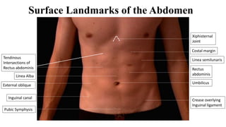 Surface landmark of the abdomen | PPT