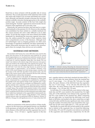 Section Transverse Sigmoid Sinus