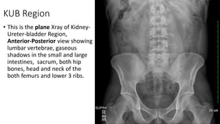 Surface marking radiology abdomen | PPTX