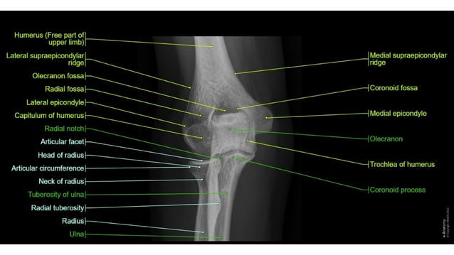 SURFACE MARKING & RADIOLOGY OF UPPER LIMB.pptx