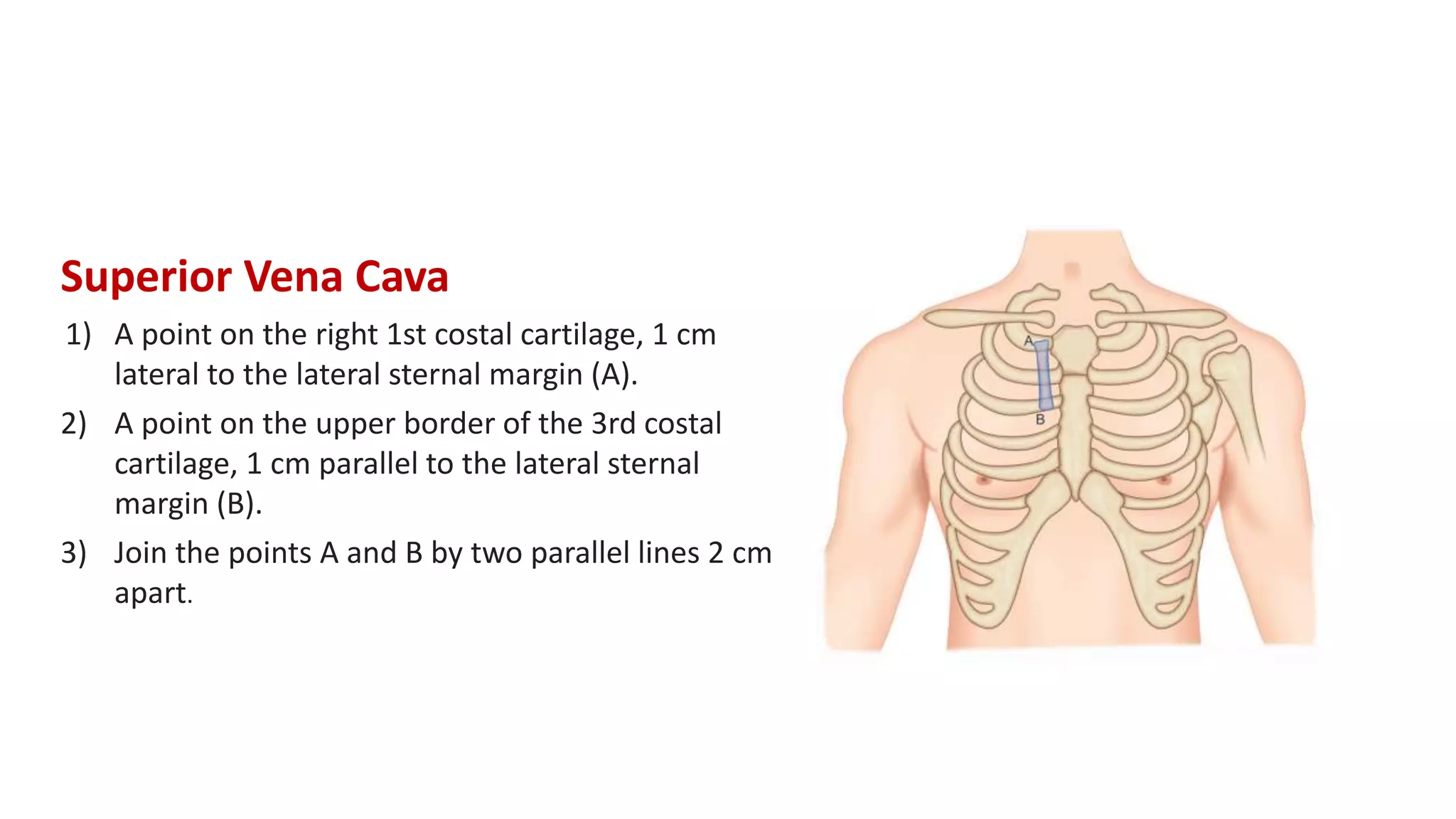 Surface Markings of Thorax.pptx