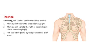 Sternal Angle Surface Anatomy