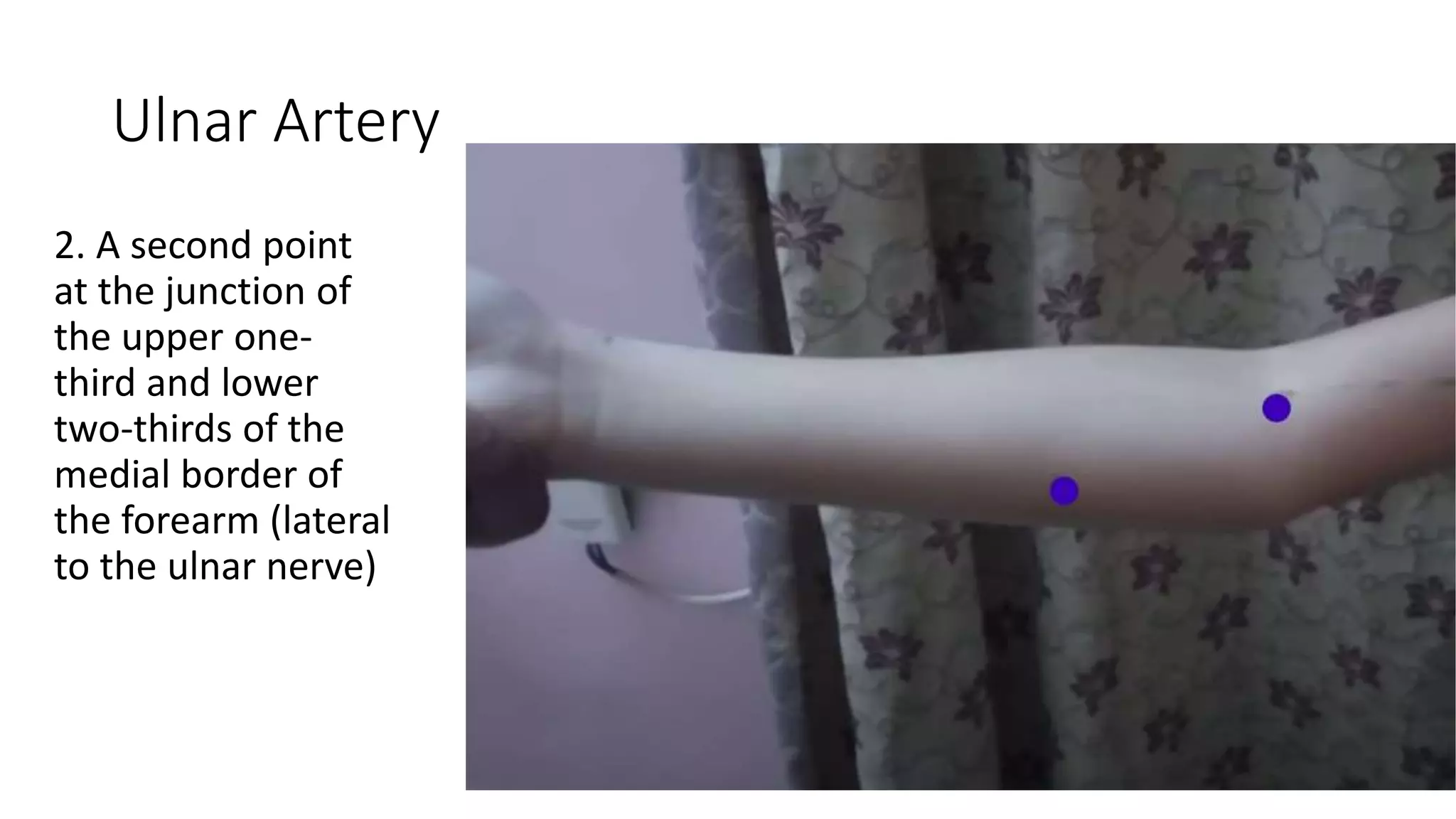 Surface marking upper limb | PPTX