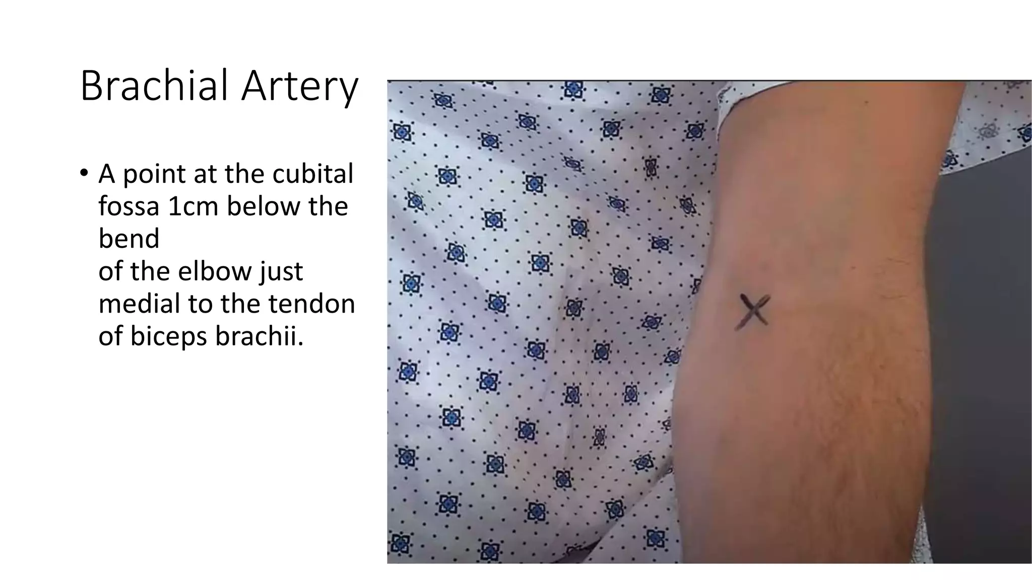 Surface marking upper limb | PPTX