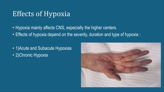SURFACTANT AND HYPOXIA PPT 2.pptx - BY DR SD & NARENDRA YADAV | PPTX
