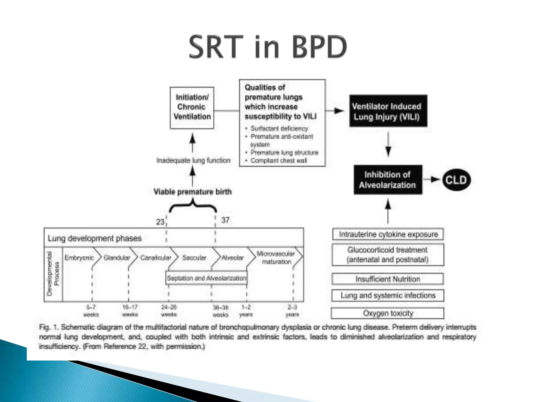 Surfactant replacement therapy : RDS & beyond | PPTX