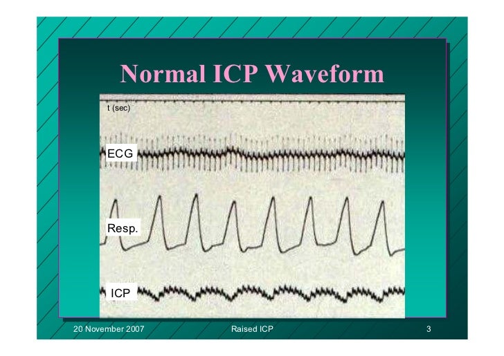 Surg351 presentation and management of raised intracranial pressure