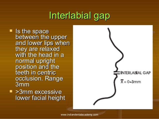Surg analysis ii /certified fixed orthodontic courses by Indian dent…