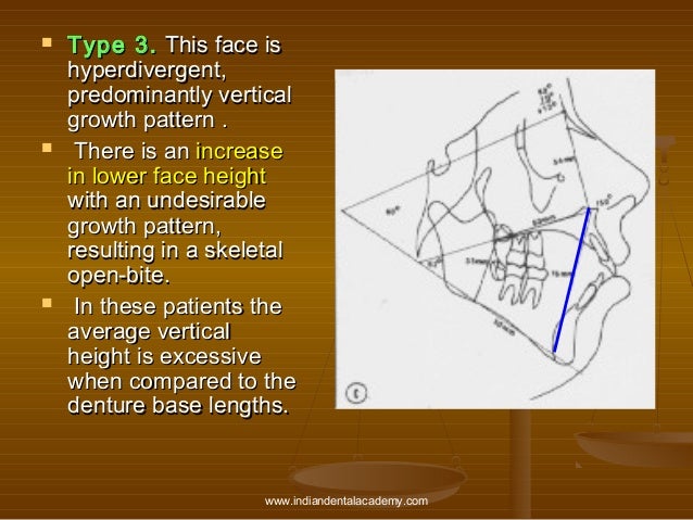 Surgical analysis in orthodontics /certified fixed orthodontic course…