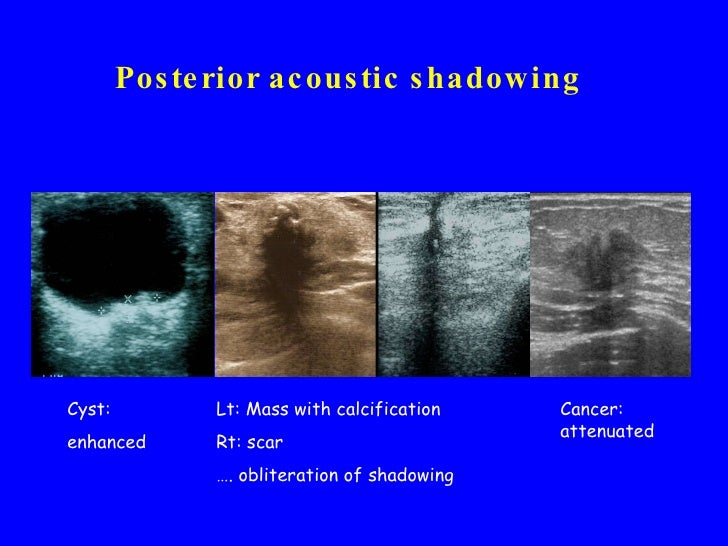 Surgeon performed ultrasound