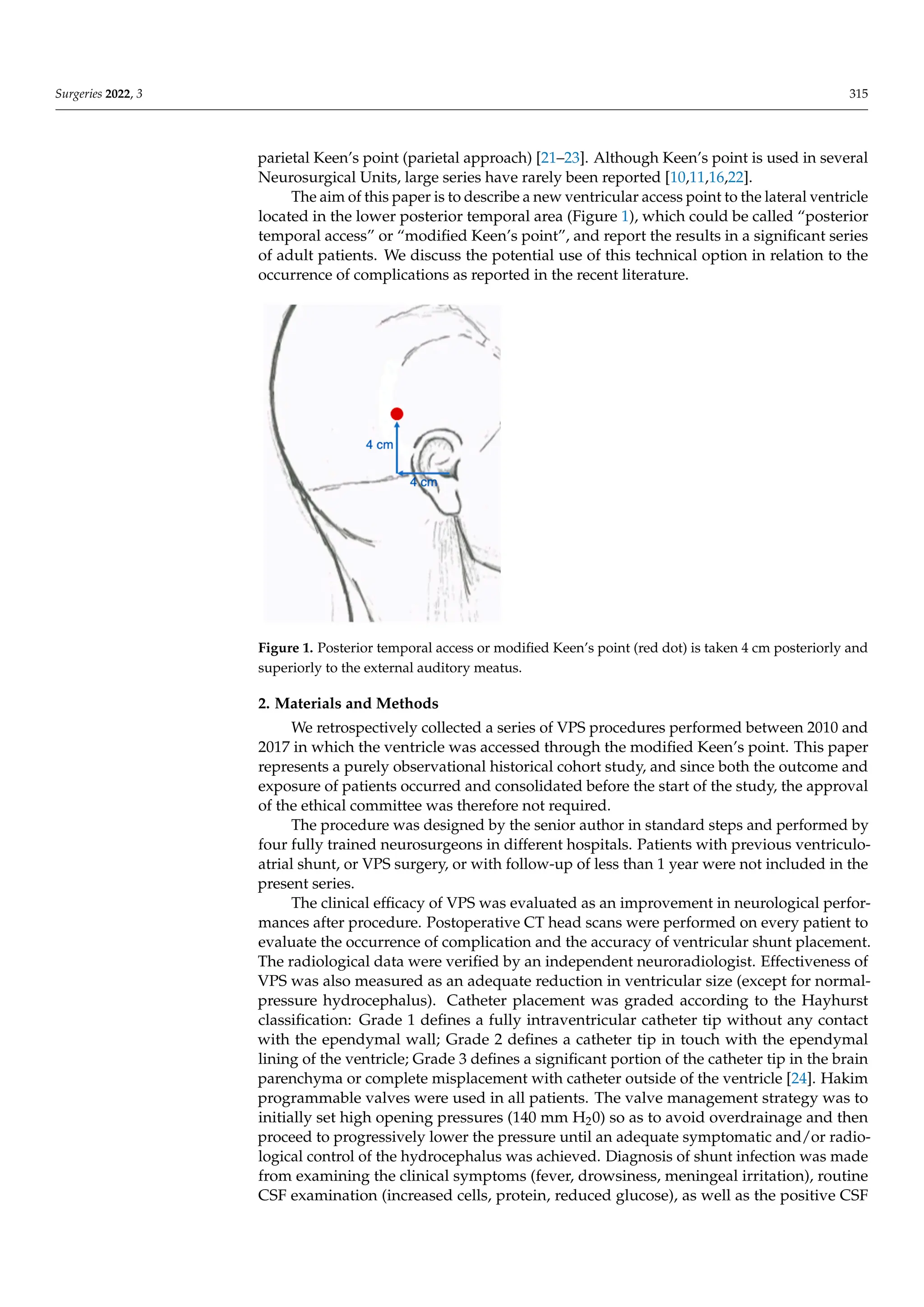 surgeries-03-00034 vp shunt surgery using modified keens point ...
