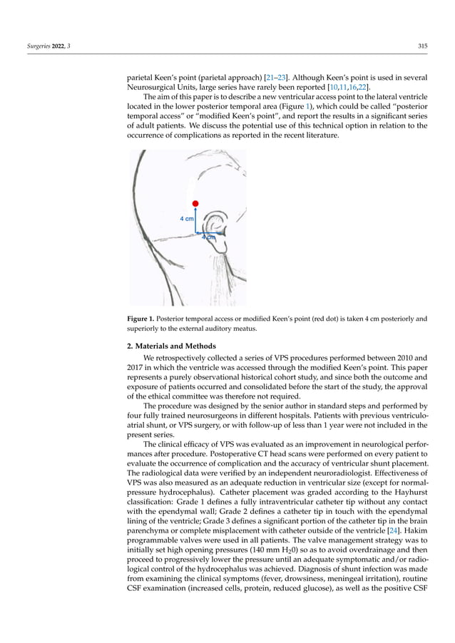 surgeries-03-00034 vp shunt surgery using modified keens point ...