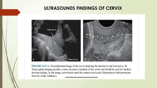 SURGERIES FOR CERVICAL INCOMPETENCE.pptx
