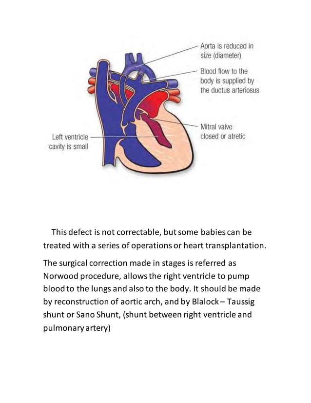 Surgeries for complex congenital heart disease | DOCX