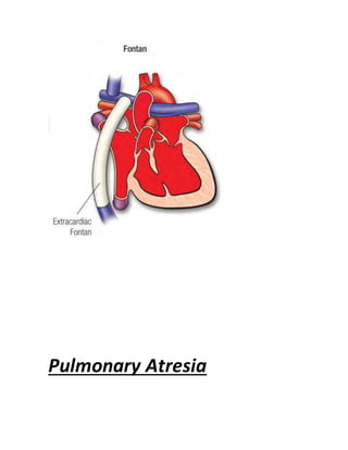 Surgeries for complex congenital heart disease | DOCX