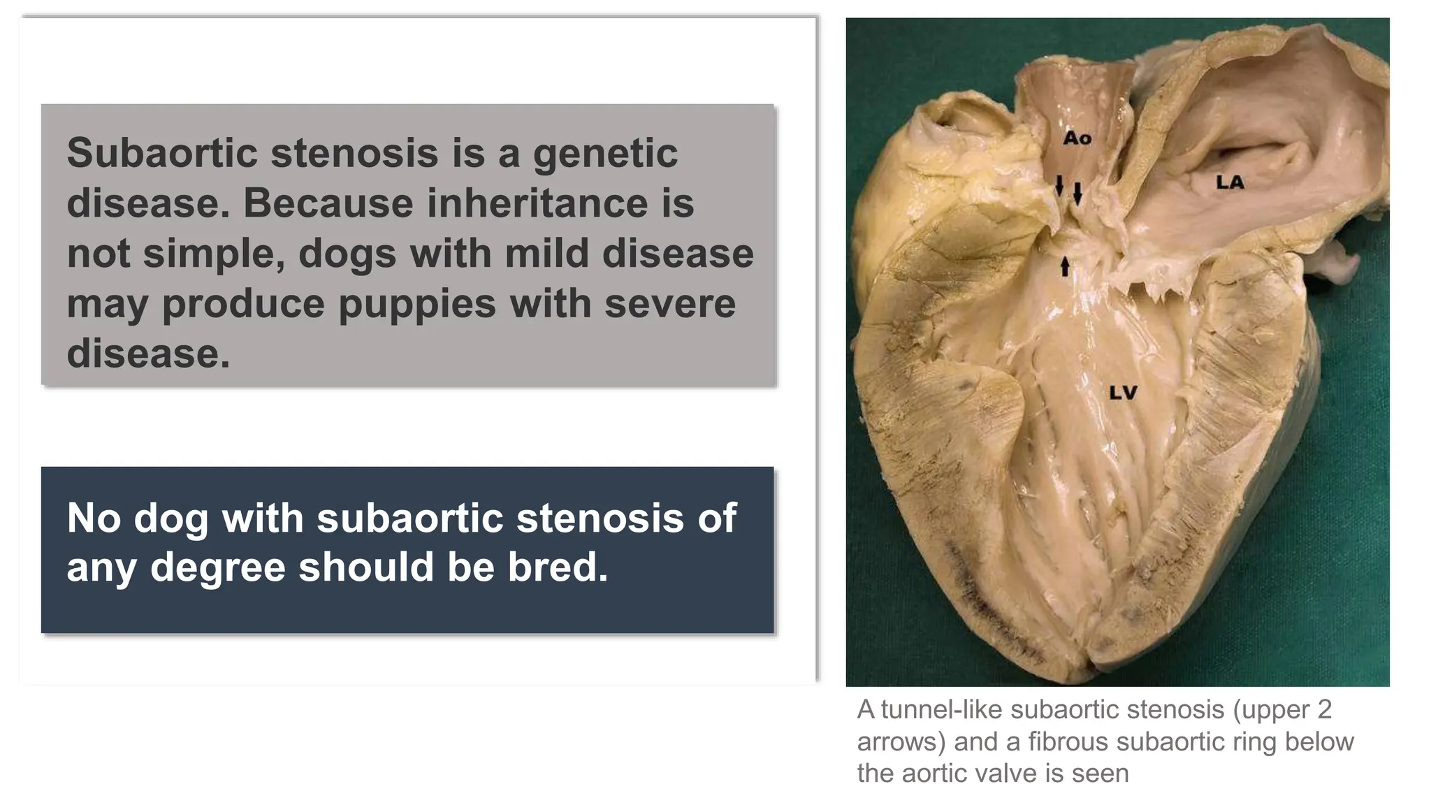 Surgeries of cardiovascular system MEENU PM.pptx