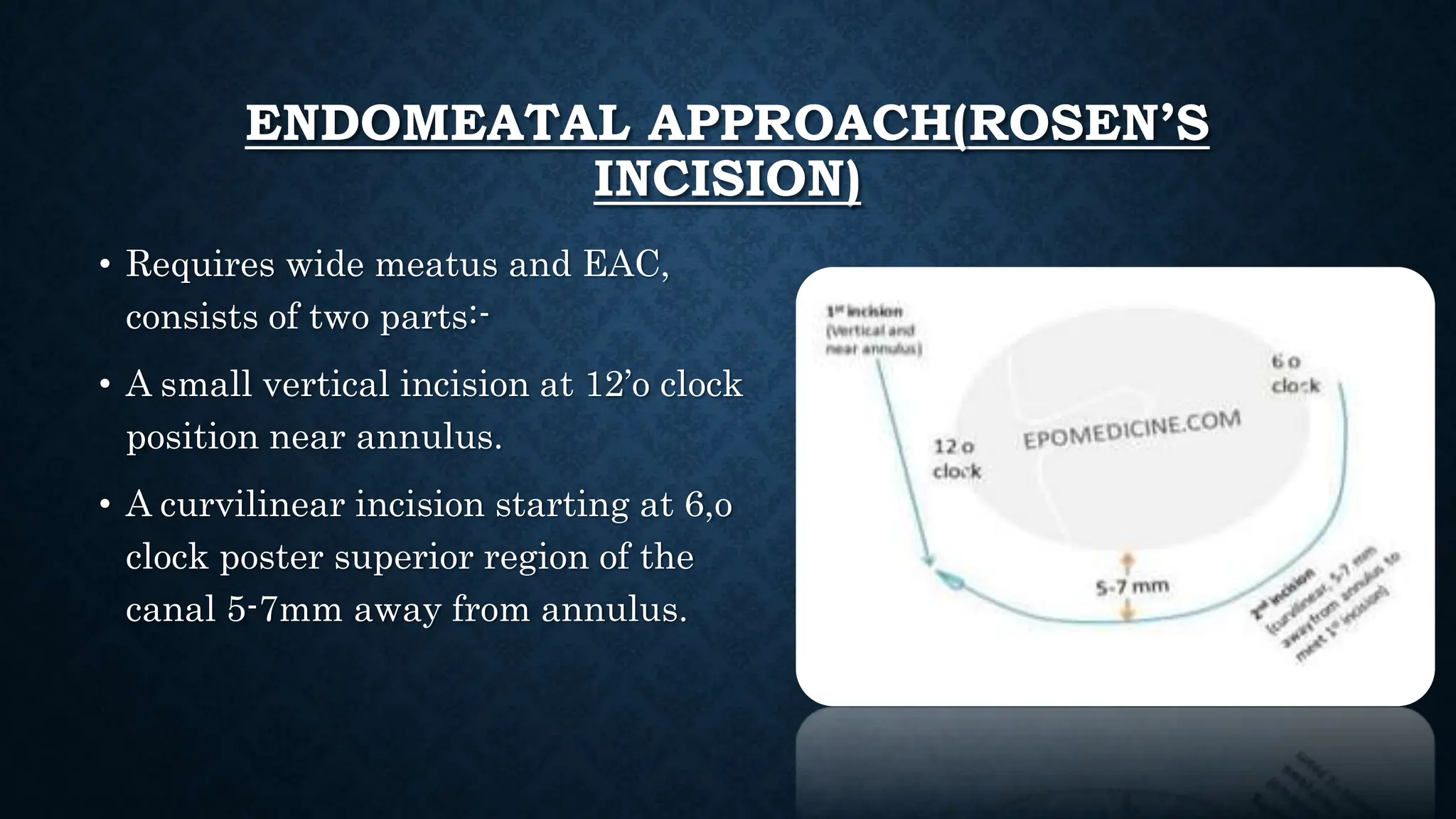 surgeries of ear.pptx