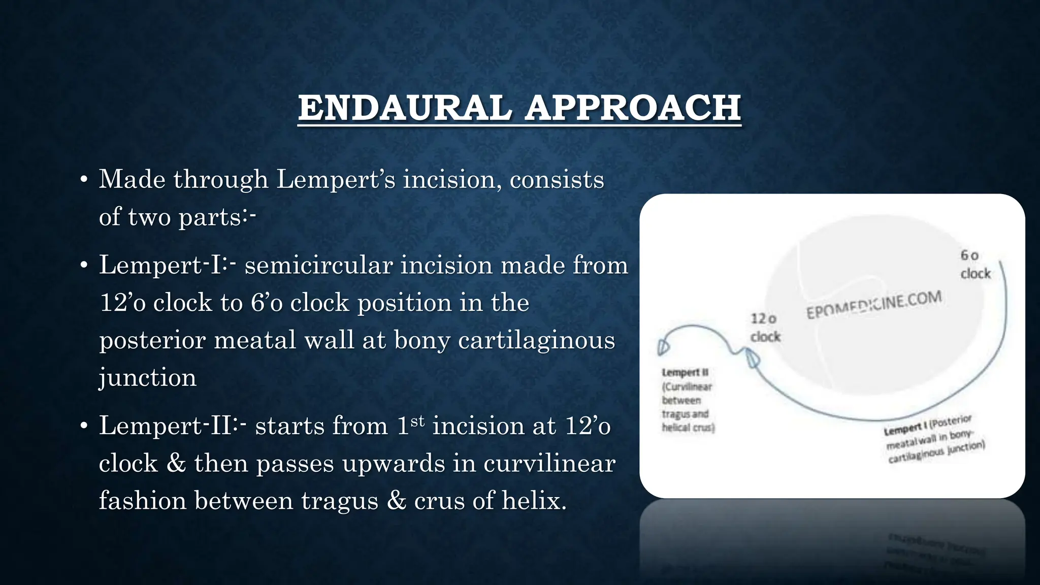 surgeries of ear.pptx