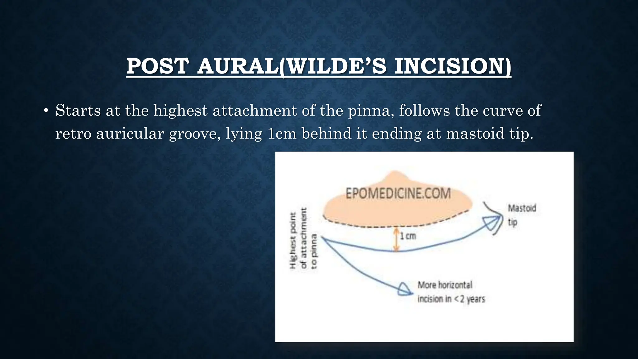 surgeries of ear.pptx