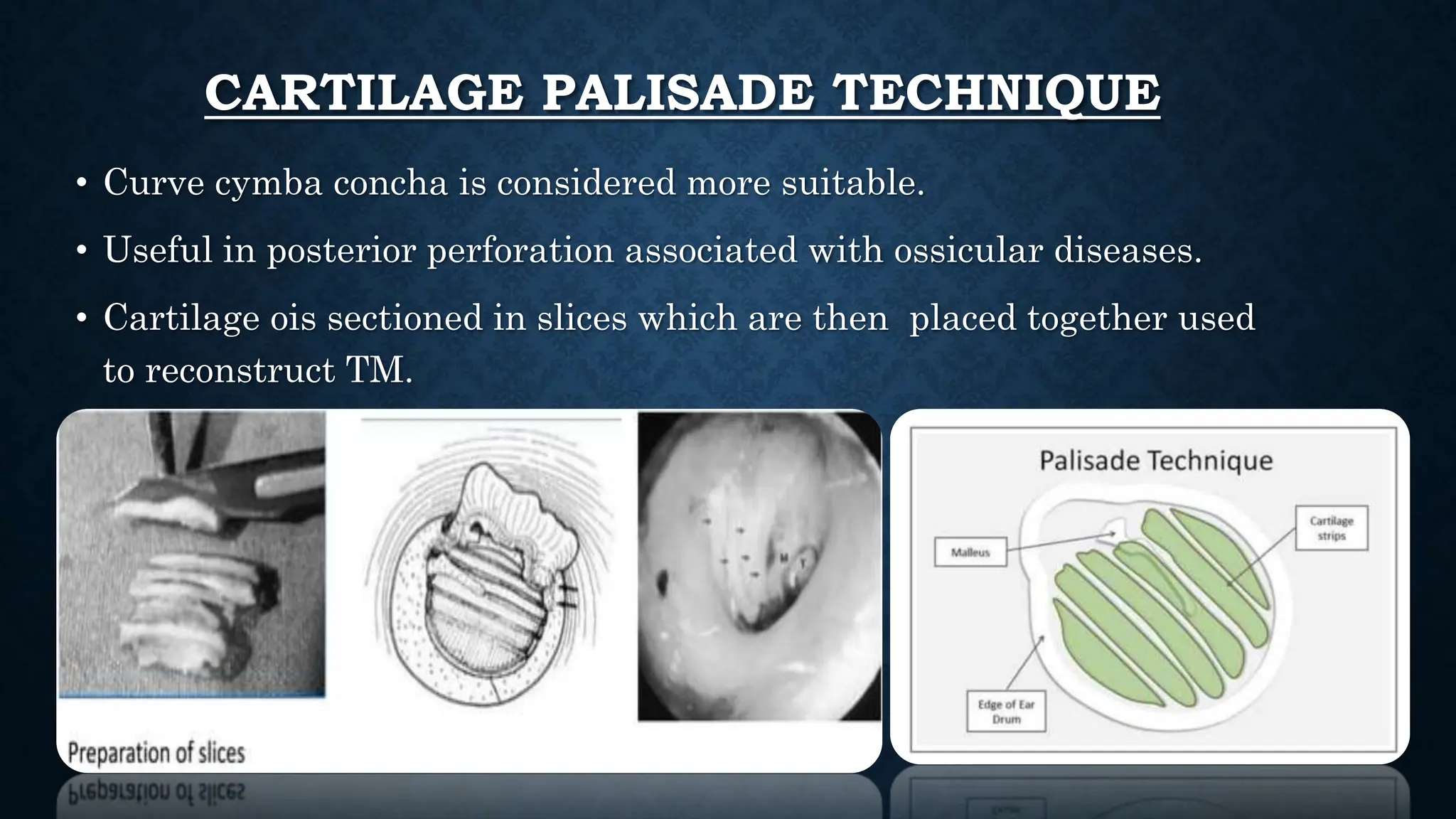surgeries of ear.pptx