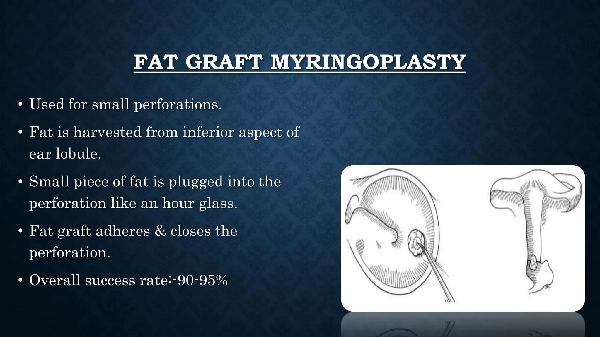 surgeries of ear.pptx