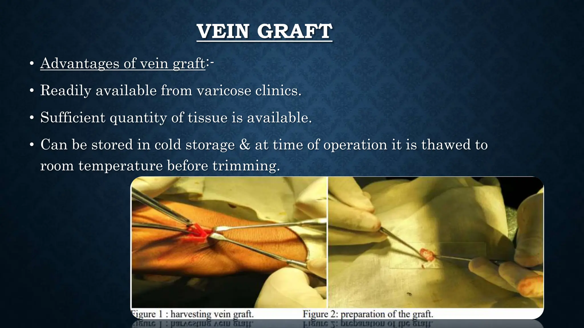 surgeries of ear.pptx