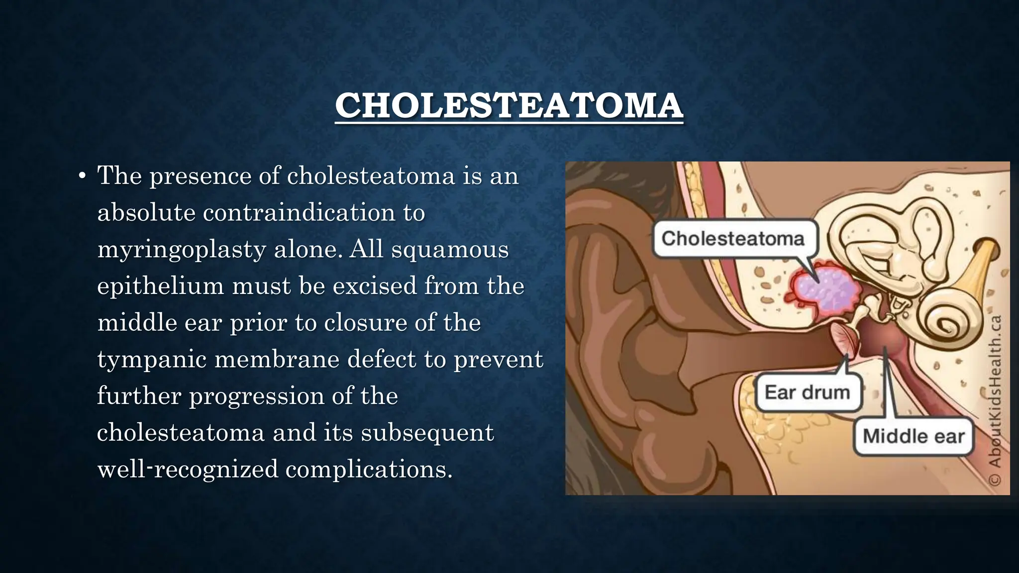 surgeries of ear.pptx