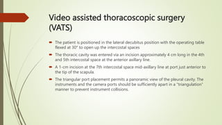 Surgeries of pleura and intercostal catheter | PPT