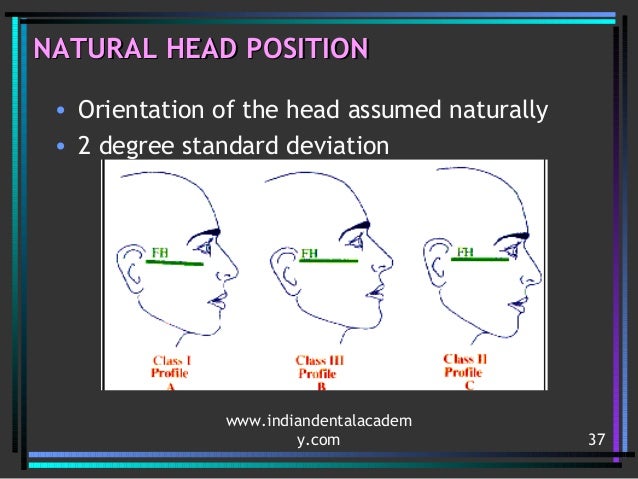 Surgery /certified fixed orthodontic courses by Indian dental academ…