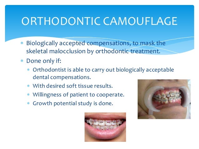 Pre-Surgical procedures in orthognathic surgeries of mandible.