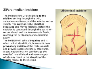 INTRODUCTION to Surgery | PPTX